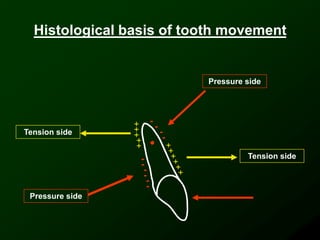 Biomechanics of Orthodontic Tooth Movement _2 - Dr. Nabil Al-Zubair | PPTX