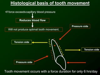 Biomechanics of Orthodontic Tooth Movement _2 - Dr. Nabil Al-Zubair | PPTX