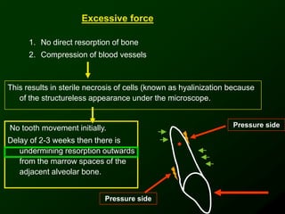 Biomechanics of Orthodontic Tooth Movement _2 - Dr. Nabil Al-Zubair | PPTX