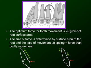 Biomechanics of Orthodontic Tooth Movement _2 - Dr. Nabil Al-Zubair | PPTX