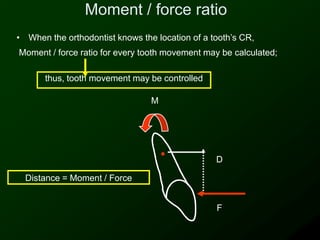 Biomechanics of Orthodontic Tooth Movement _2 - Dr. Nabil Al-Zubair | PPTX