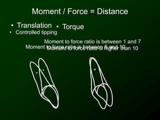 Biomechanics of Orthodontic Tooth Movement _2 - Dr. Nabil Al-Zubair | PPT