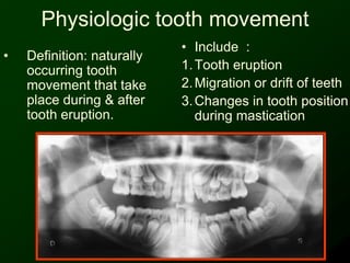 Biomechanics of Orthodontic Tooth Movement _2 - Dr. Nabil Al-Zubair | PPTX