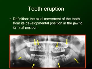 Biomechanics of Orthodontic Tooth Movement _2 - Dr. Nabil Al-Zubair | PPTX