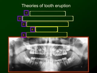 Biomechanics of Orthodontic Tooth Movement _2 - Dr. Nabil Al-Zubair | PPTX