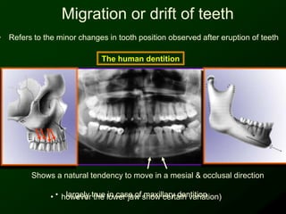 Biomechanics of Orthodontic Tooth Movement _2 - Dr. Nabil Al-Zubair | PPTX