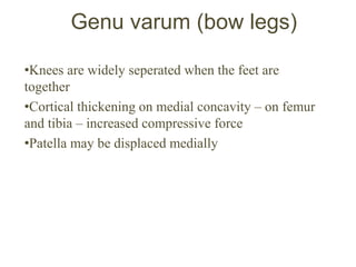 Biomechanics of posture | PPTX