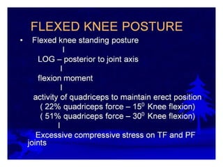 Over Flexed Posture Standing