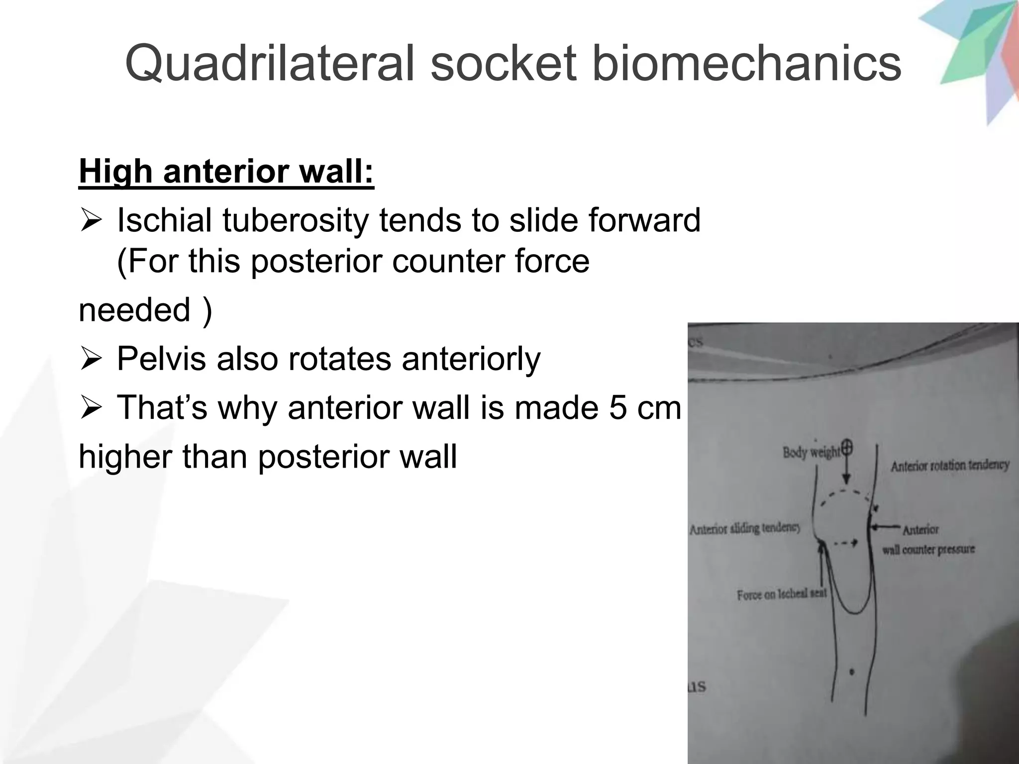 Biomechanics of Quadrilateral socket | PPTX