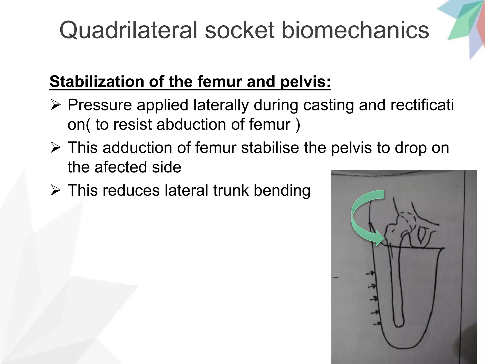 Biomechanics of Quadrilateral socket | PPTX