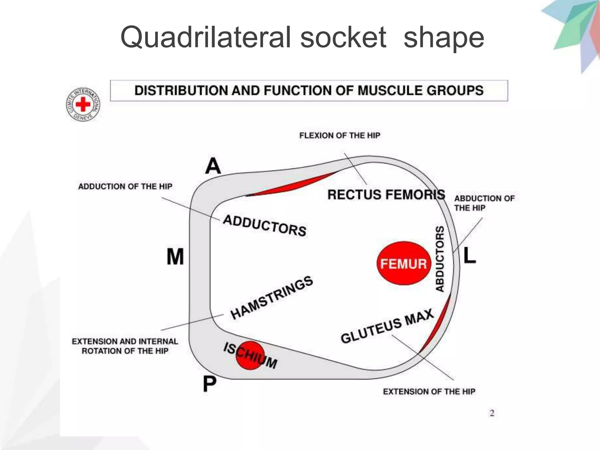 Biomechanics of Quadrilateral socket | PPTX