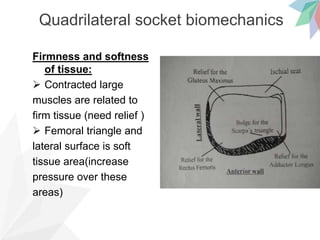Biomechanics of Quadrilateral socket | PPTX