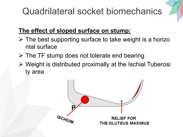 Biomechanics of Quadrilateral socket | PPTX