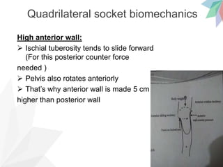 Biomechanics of Quadrilateral socket | PPTX