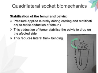 Biomechanics of Quadrilateral socket | PPTX