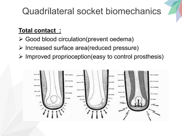 Biomechanics of Quadrilateral socket | PPTX