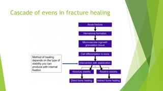 Biomechanics of Rigid Fixation and Achieving Absolute Stability in ...