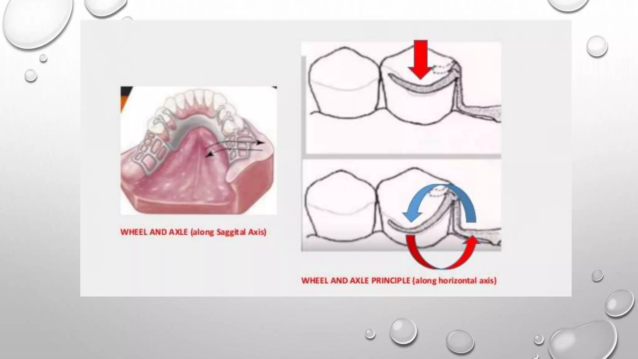 Biomechanics of RPD | PPTX