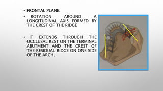 Biomechanics of RPD | PPTX