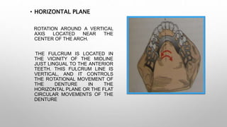 Biomechanics of RPD | PPTX