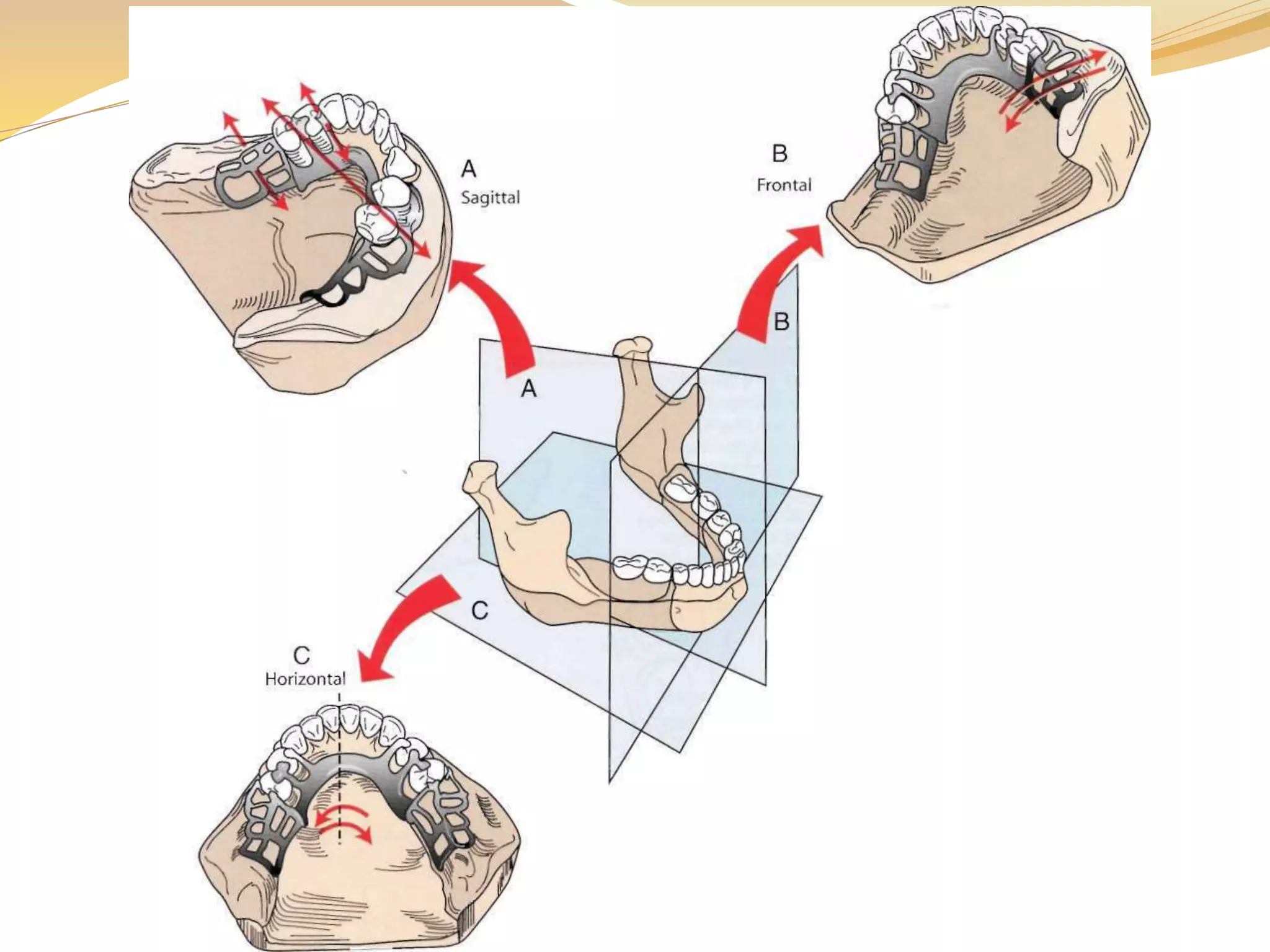 Biomechanics of RPD | PPTX