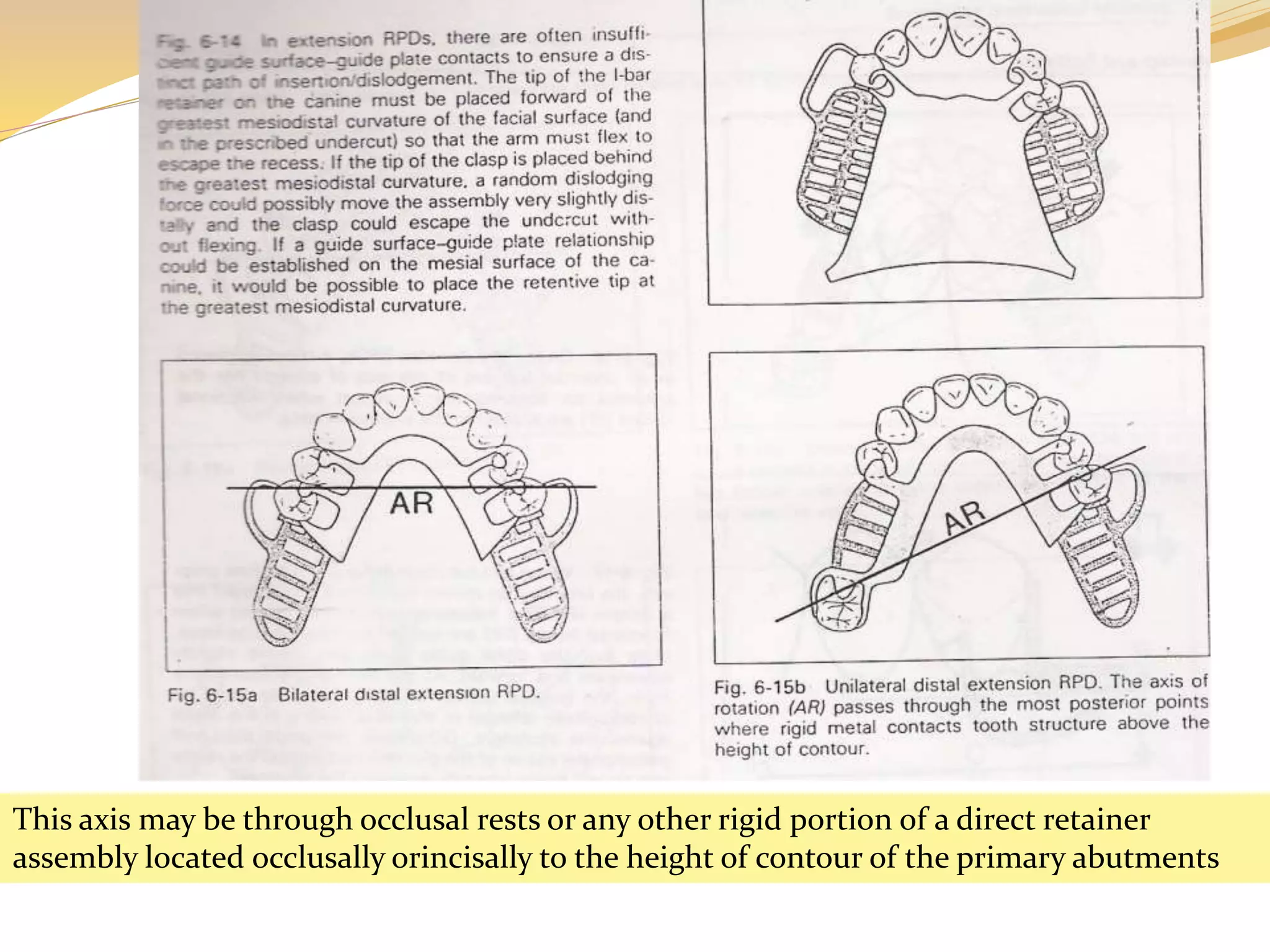 Biomechanics of RPD | PPTX