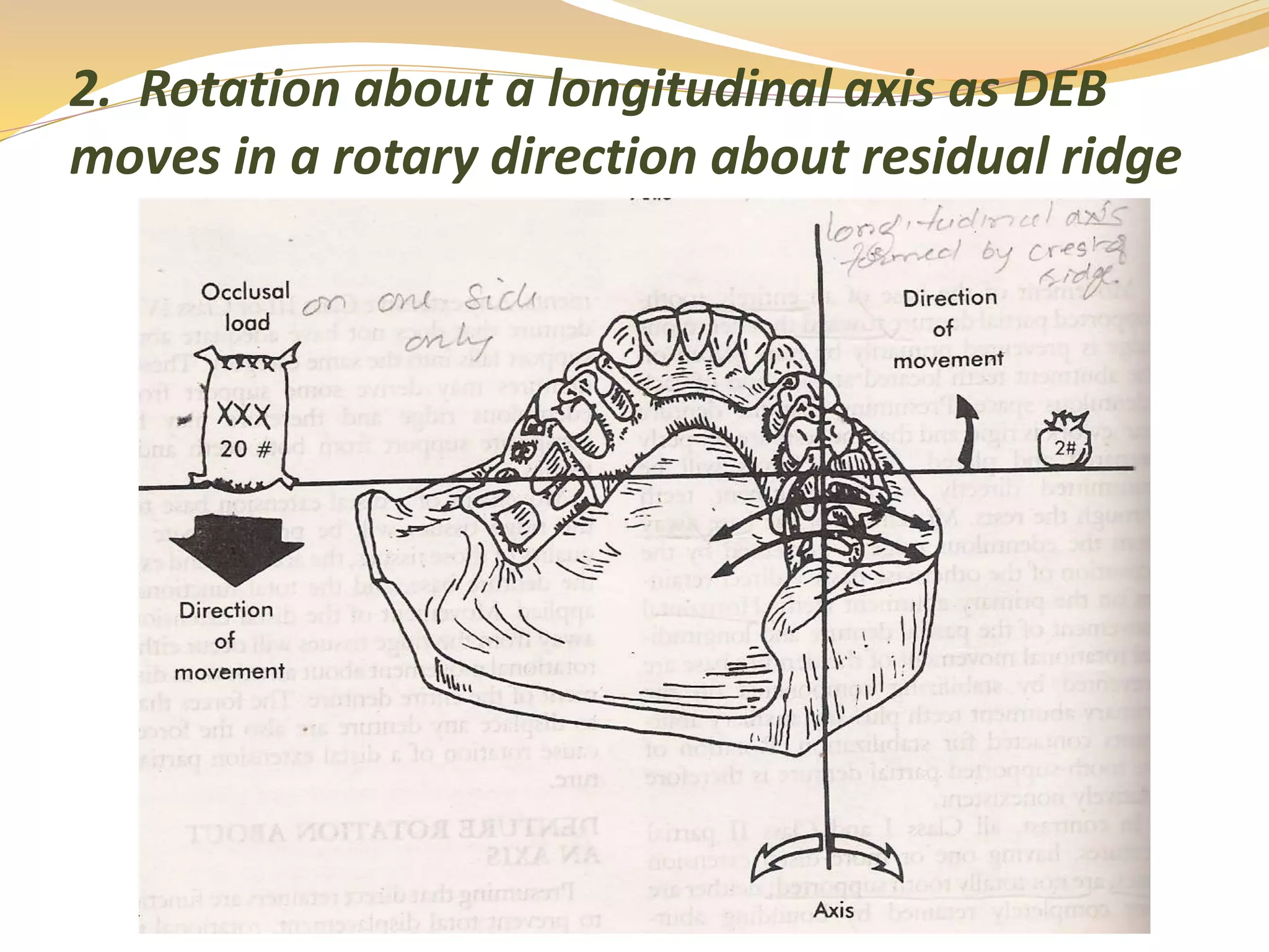 Biomechanics of RPD | PPTX | Dental Health | Diseases and Conditions