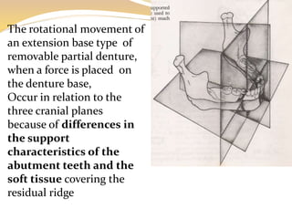 Biomechanics of RPD | PPTX