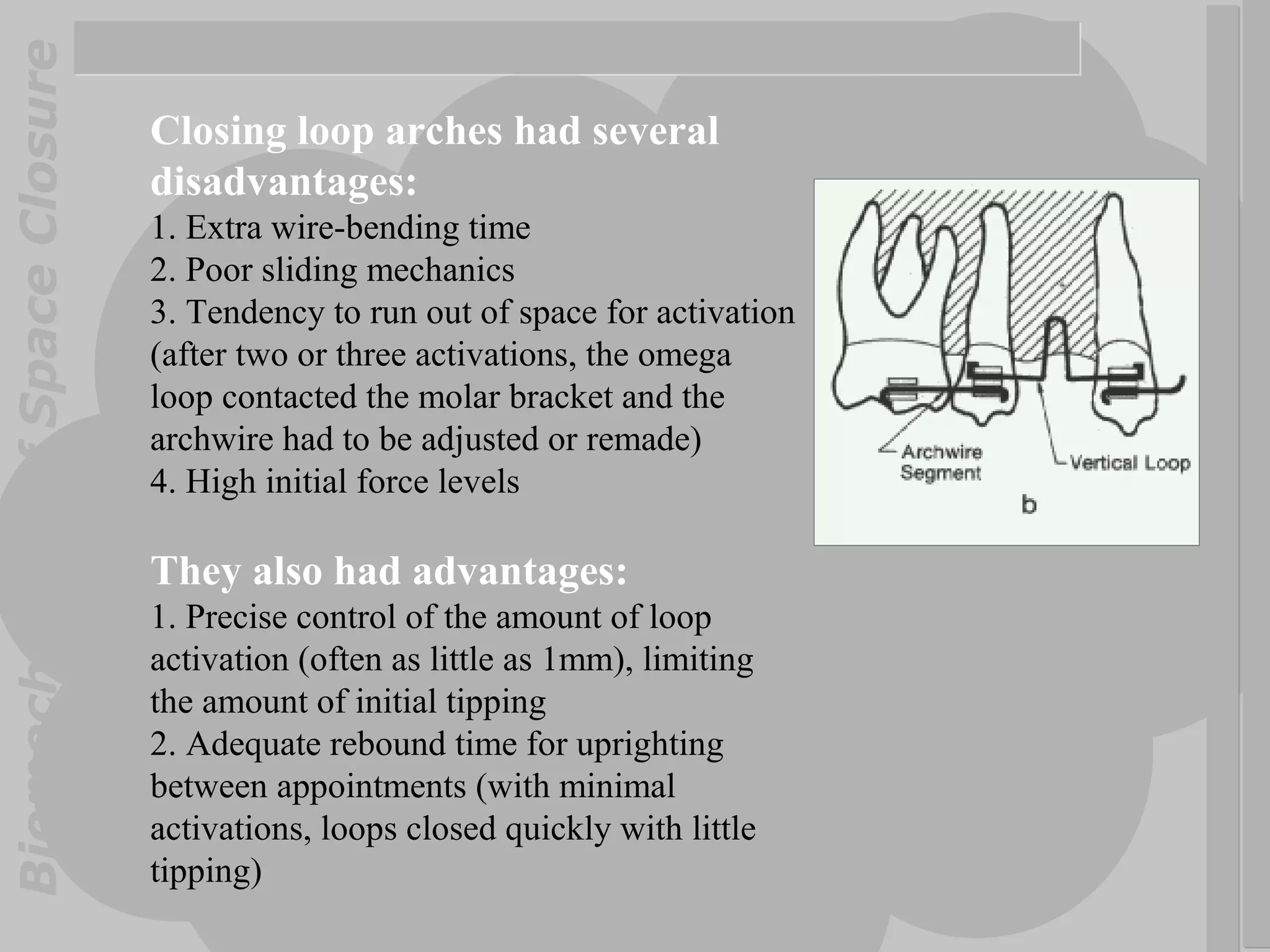 Biomechanics of space closure | PPT