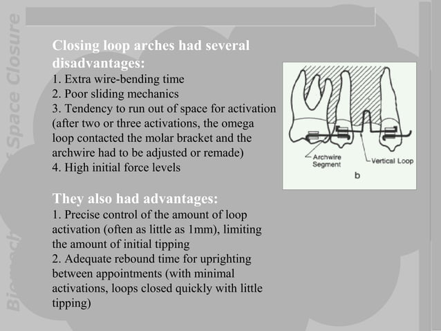Biomechanics of space closure | PPT | Dental Health | Diseases and ...