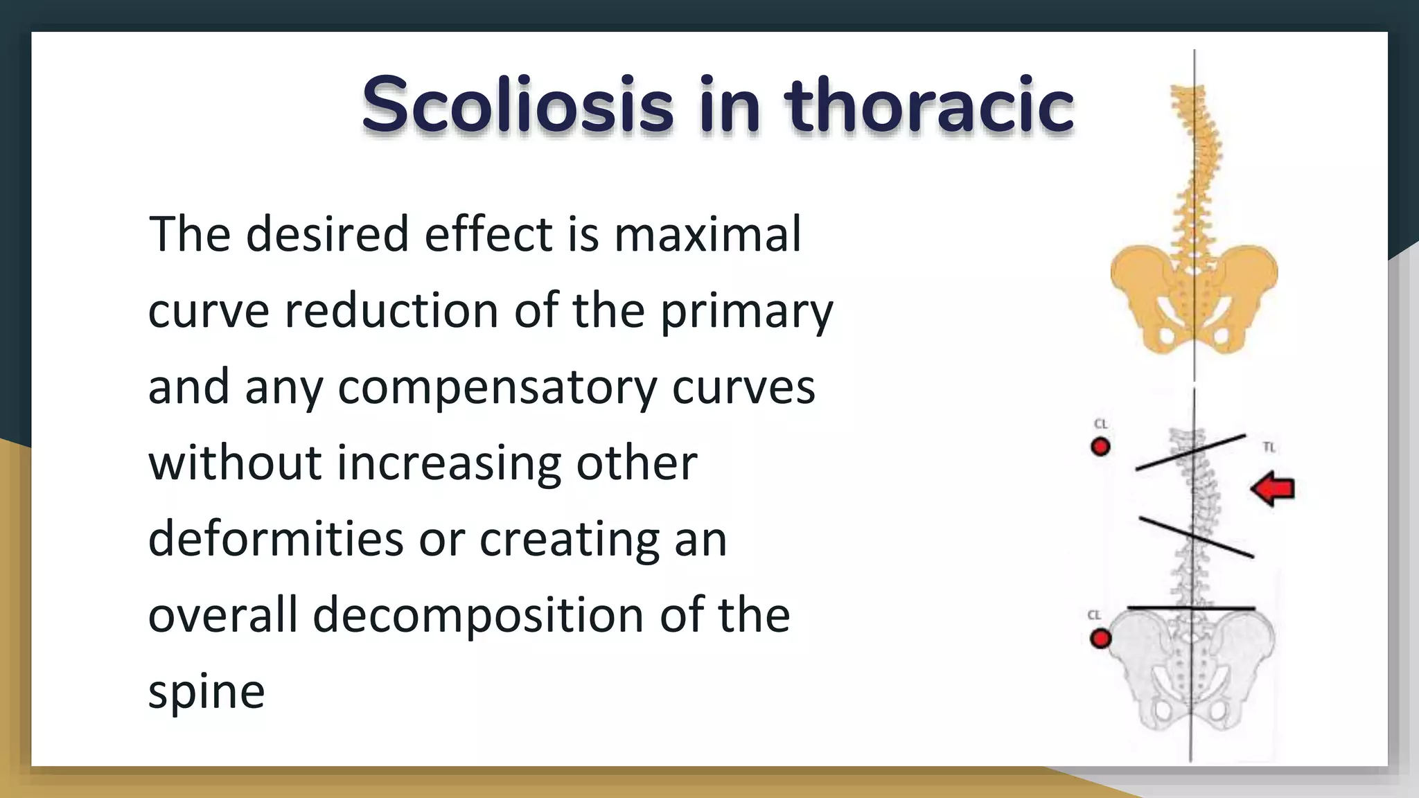 Biomechanics of spinal orthotics (MD.Nayeem hasan) | PPTX