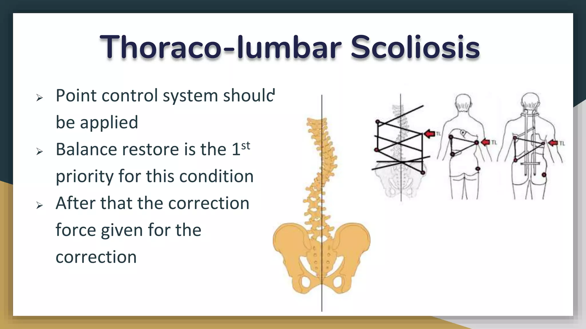 Biomechanics of spinal orthotics (MD.Nayeem hasan) | PPTX