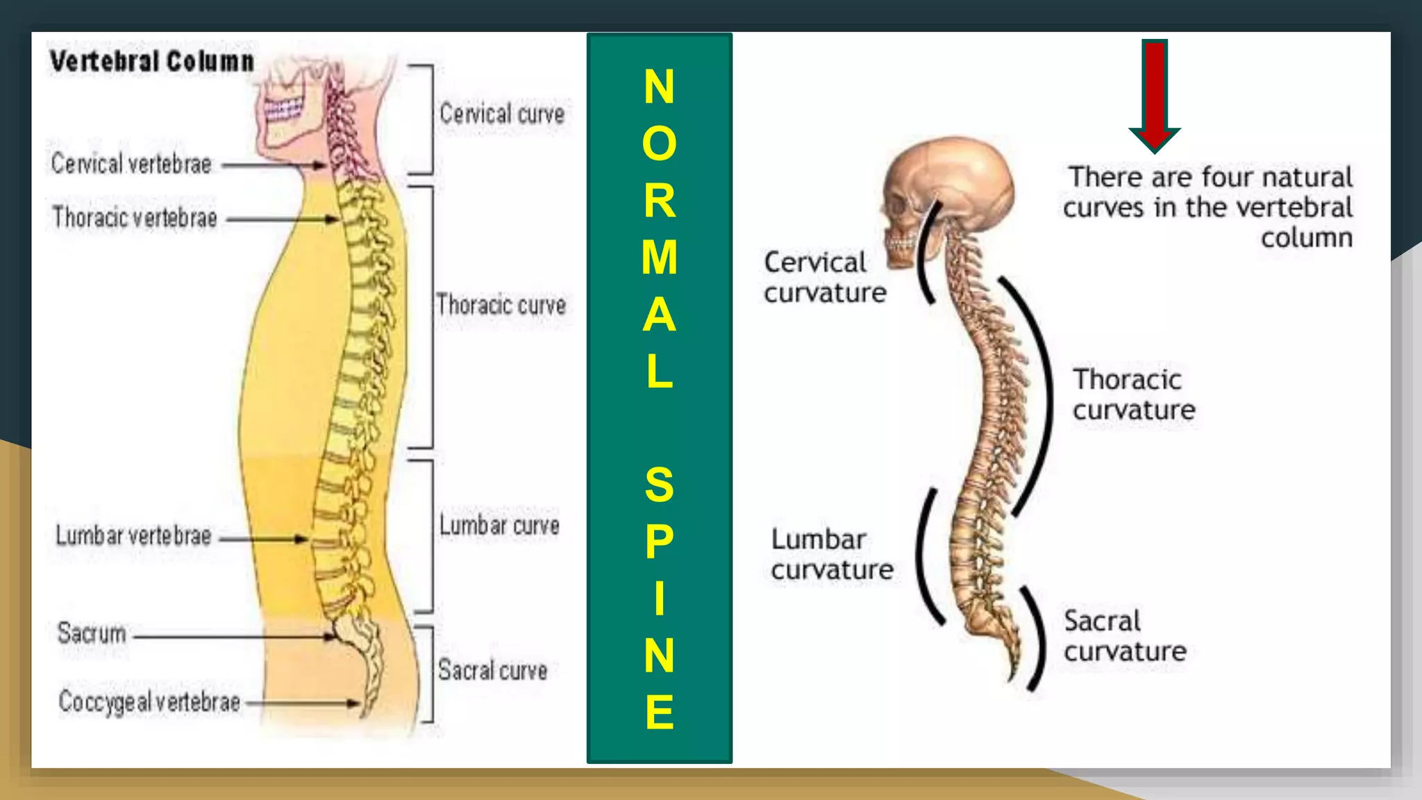 Biomechanics of spinal orthotics (MD.Nayeem hasan) | PPTX