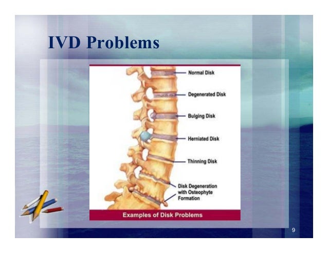 Biomechanics of spine