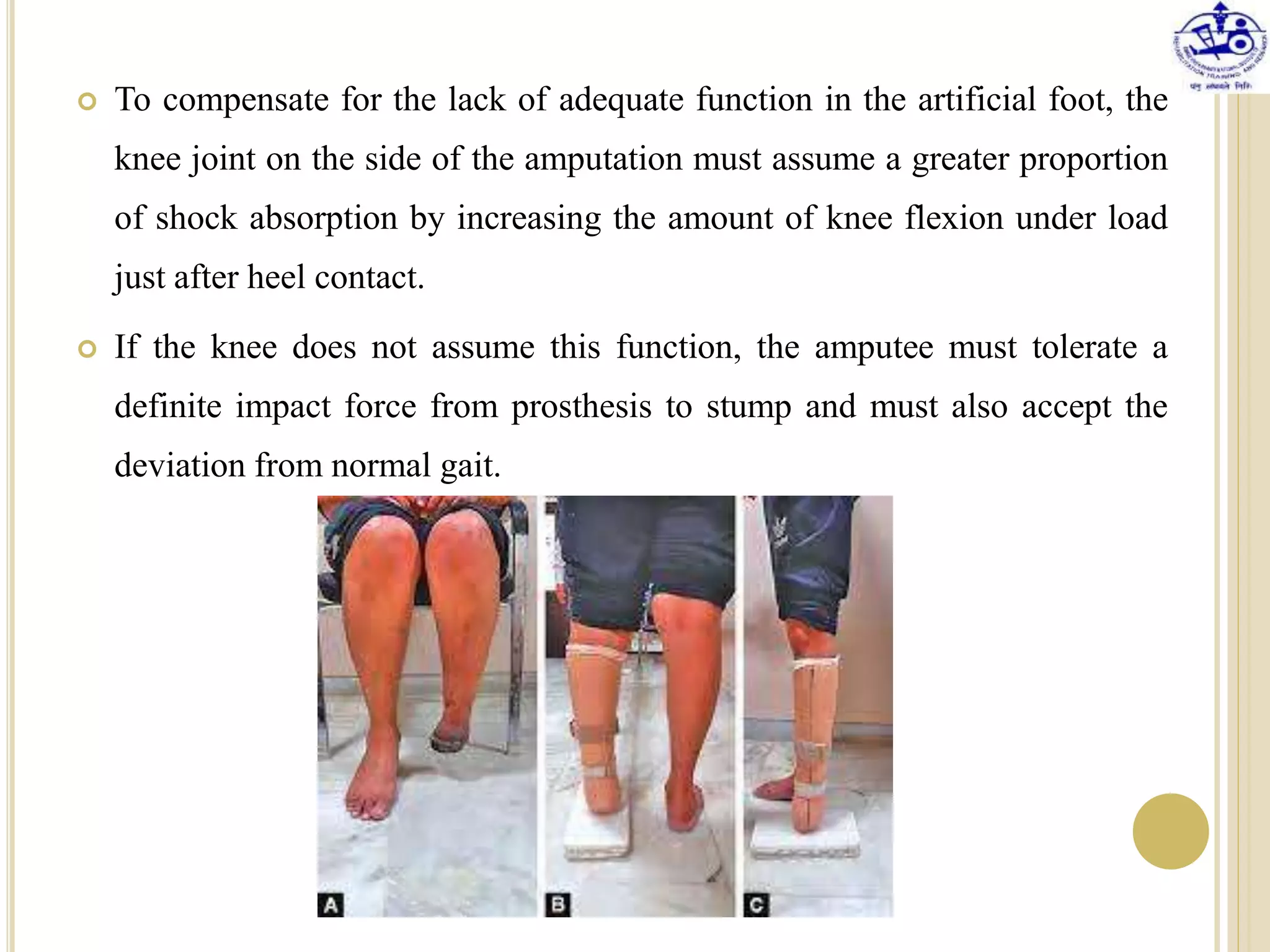 Biomechanics of symes prosthesis.pptx
