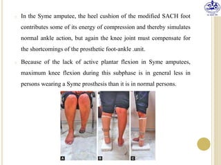 Biomechanics of symes prosthesis.pptx