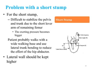 Biomechanics of TF.ppt