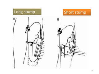 Biomechanics of TF.ppt