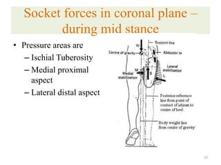 Biomechanics of TF.ppt