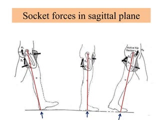 Biomechanics of TF.ppt