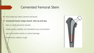 Biomechanics of THA AIIMS JODHPUR SEMINAR | PPTX