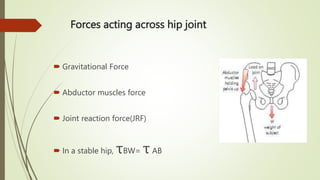 Biomechanics of THA AIIMS JODHPUR SEMINAR | PPTX