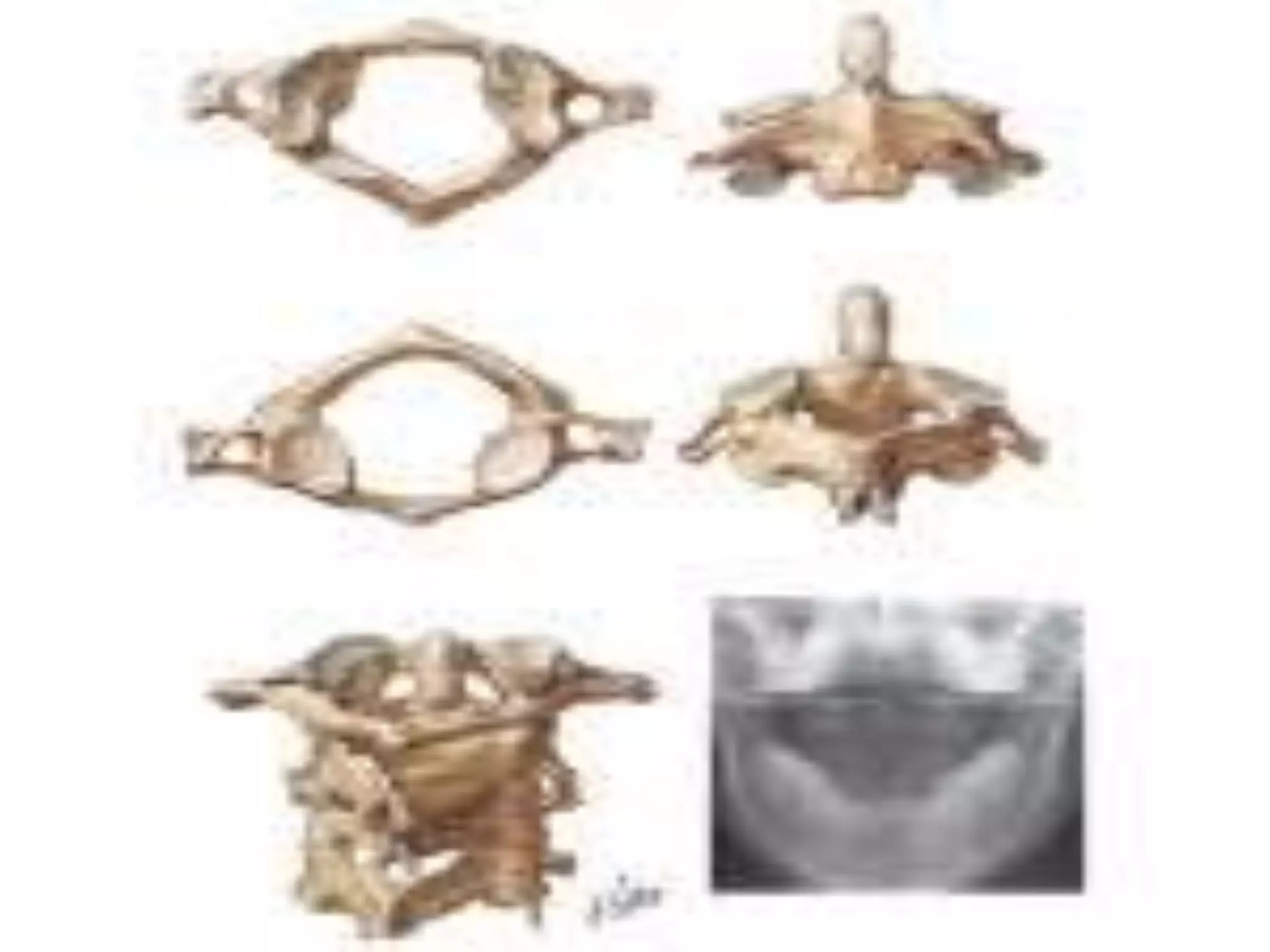 Biomechanics of the cervical spine. ppt (3) | PPTX