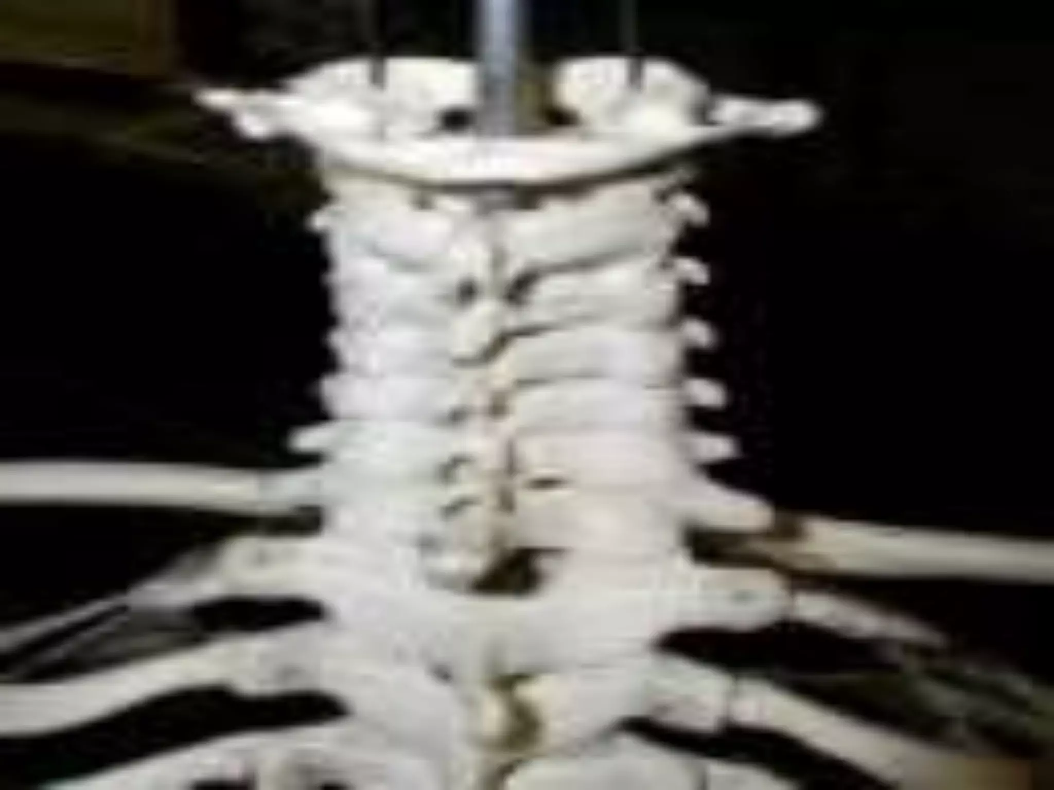Biomechanics of the cervical spine. ppt (3) | PPTX