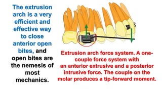 Biomechanics of the extrusion arches | PPTX