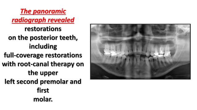 Biomechanics of the extrusion arches | PPTX | Dental Health | Diseases ...
