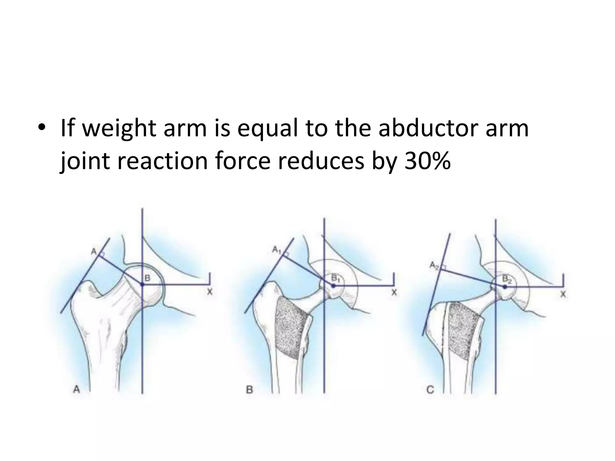 Biomechanics of the hip and knee joint | PPTX