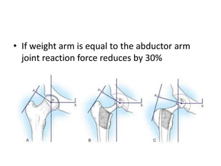 Biomechanics of the hip and knee joint | PPT