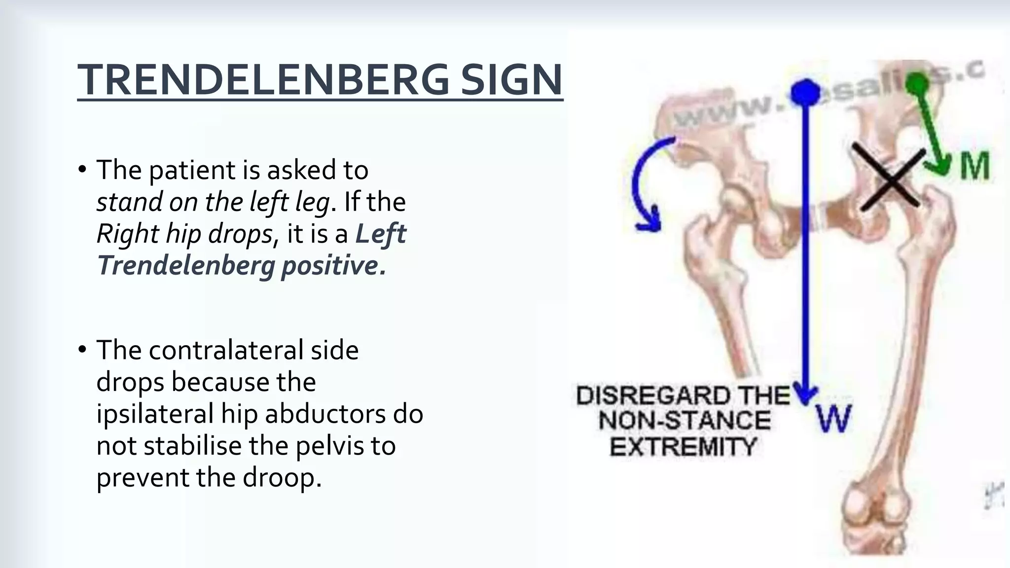 Biomechanics of the Hip Joint | PDF