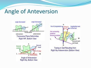 Bio-mechanics of the hip joint | PPTX